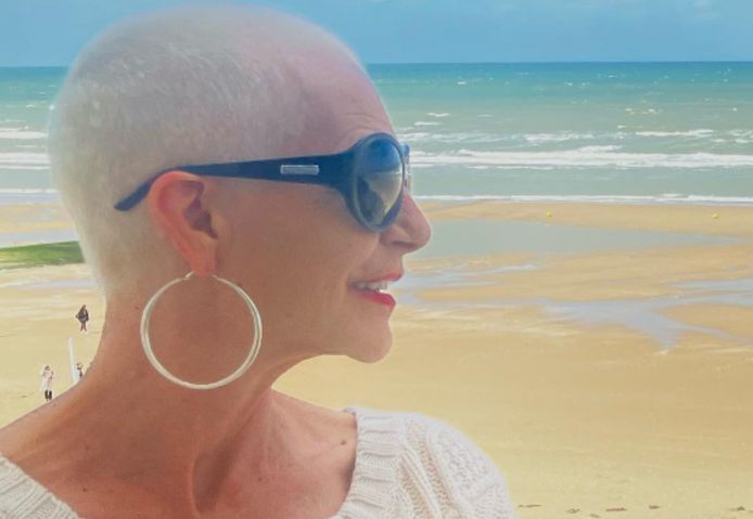 Lio se dévoile le crâne rasé: ses fans sous le charme | People | 7sur7.be