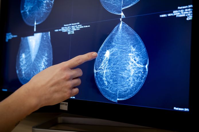 Voor deze vorm van borstkanker bestaat nog geen speciale behandeling ...