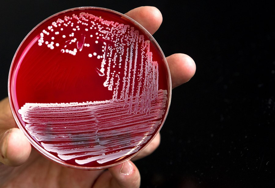 Opnamestop Twents ziekenhuis om MRSA-bacterie | Foto | AD.nl