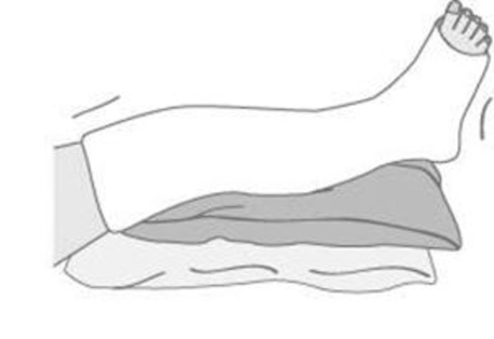 Tien weken in het gasthuis met het been omhoog | Van de lezer ...