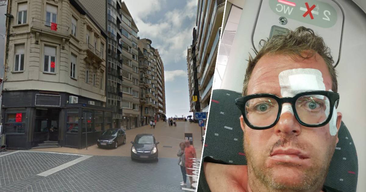 Tanguy (46) uit het niets aangevallen door zes jongeren: “Ze sloegen en schopten tot ik ...