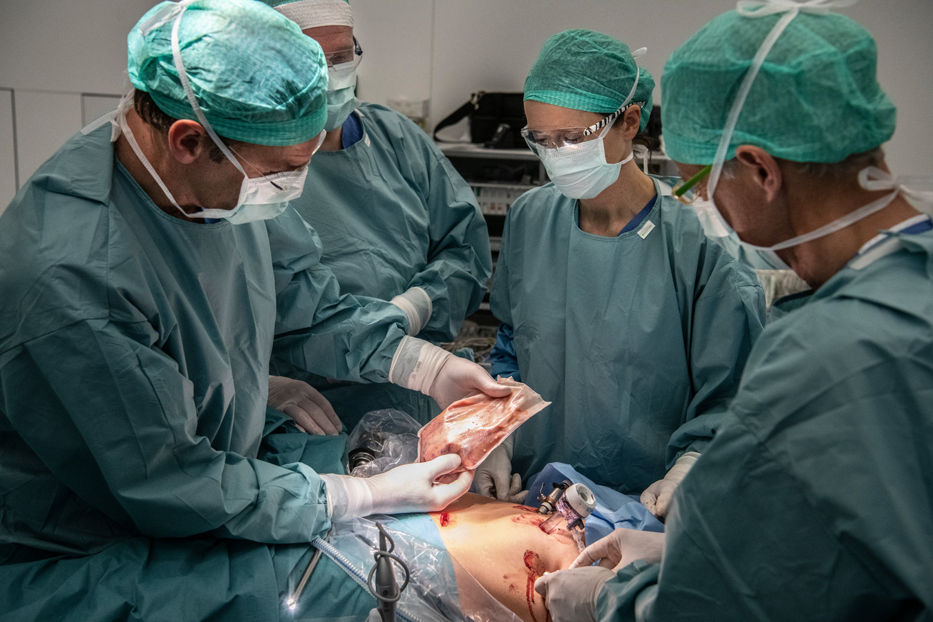 Nieuwe techniek zorgt voor unieke borstreconstructie voor slanke ...