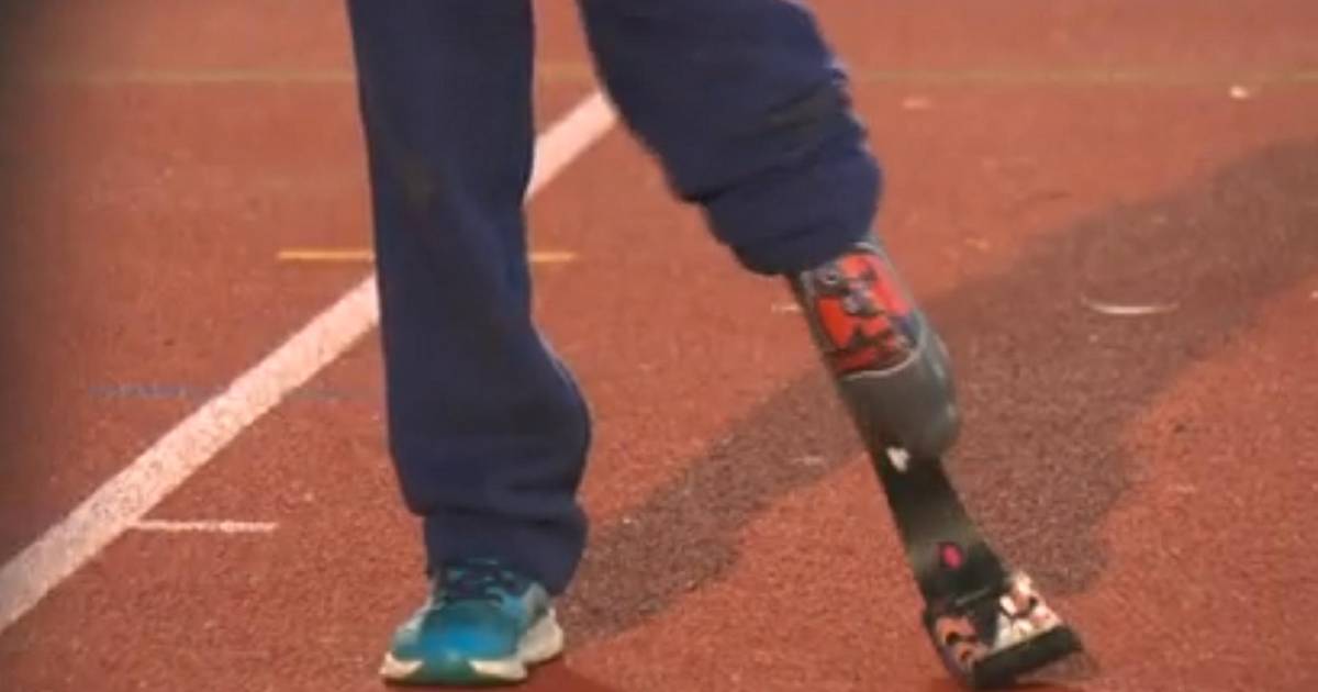 Cette association belge offre des prothèses sportives aux enfants ...