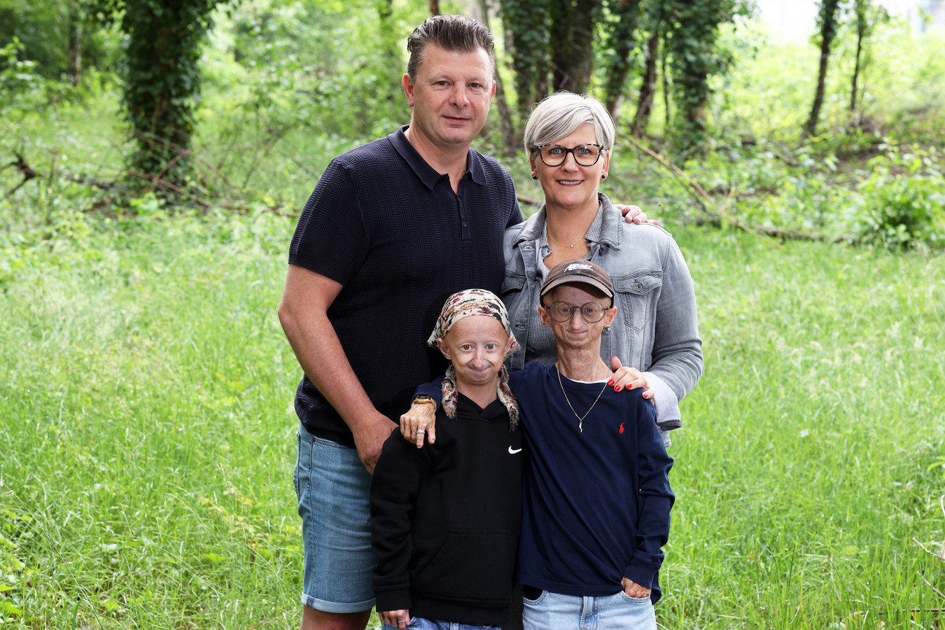 “Voor de operatie moesten ze mijn ribben breken”: progeria-patiënt ...