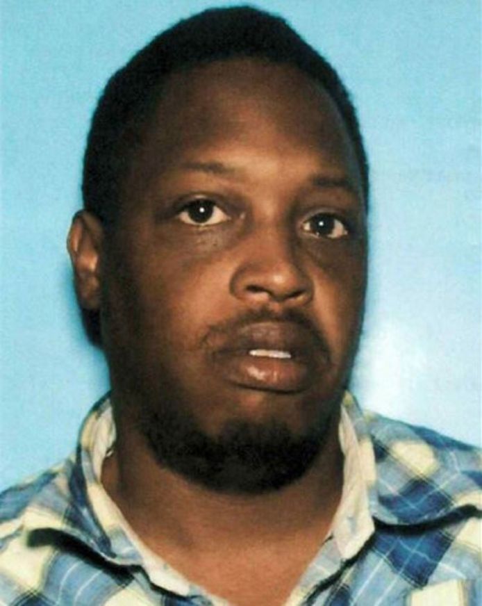 Vrouw met mysterieuze migraine blijkt kogel in hoofd te hebben. Spoor ...