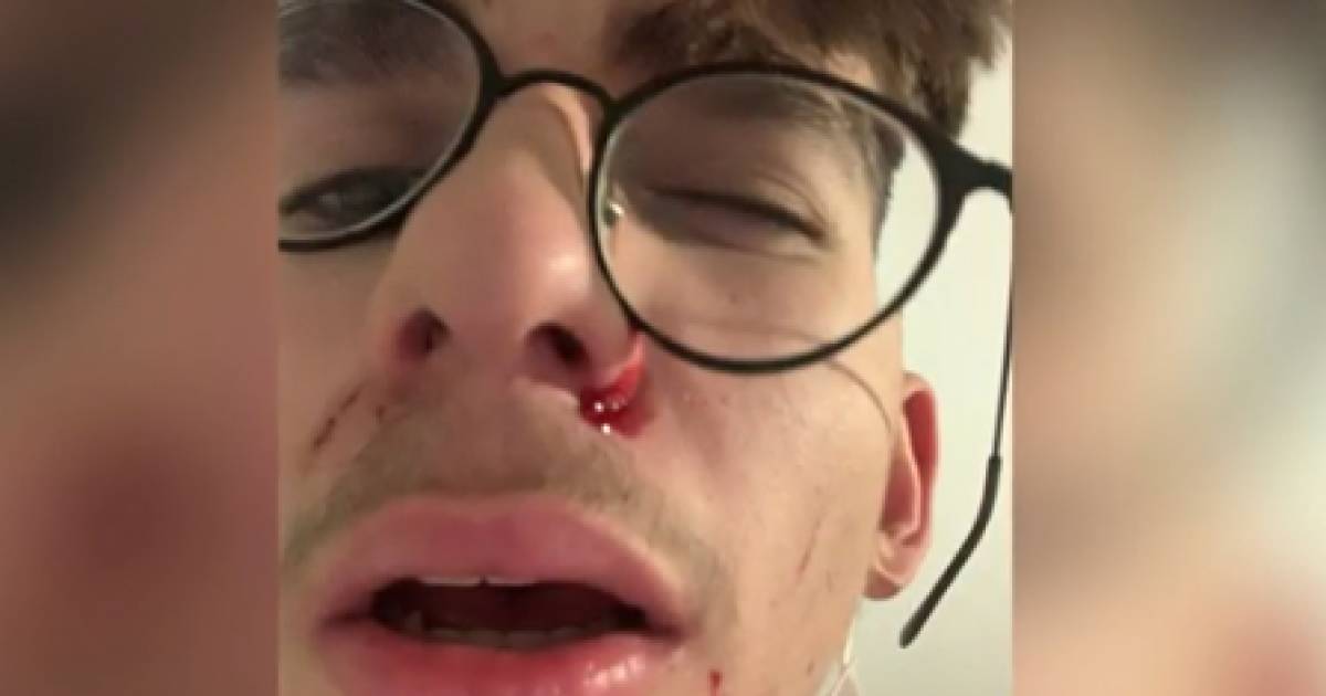 Un ado de 16 ans victime d’une agression homophobe à Couillet: “Ils ont dit que les gens comme ...