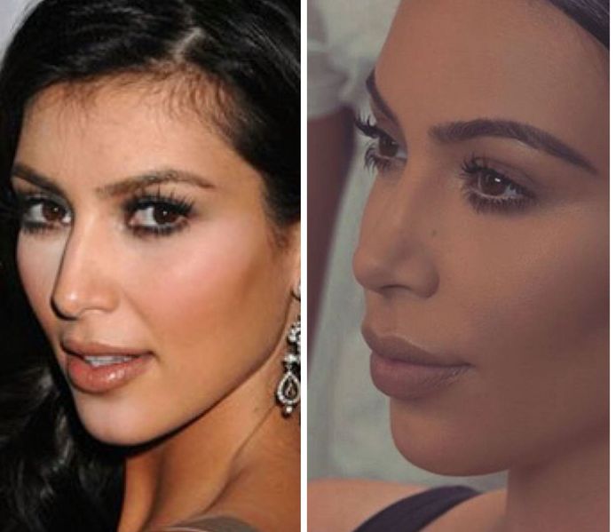 Van grotere billen tot nieuwe kaaklijn: zoveel kost het lijf van Kim ...