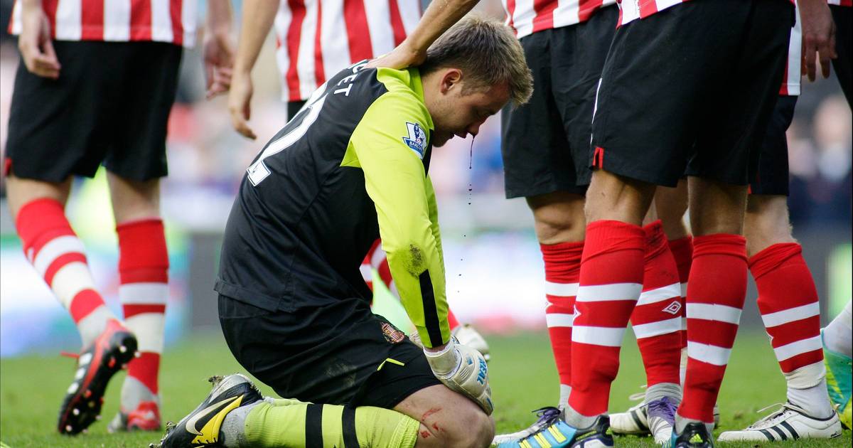 Le gardien des Diables Rouges "a le nez salement cassé" | Football ...