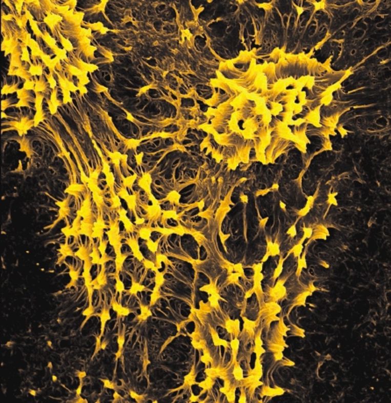 Stamcellen mogen weer in Amerika | Trouw