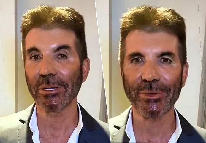 “Wat is er met zijn gezicht gebeurd?”: fans bezorgd om ‘onherkenbare’ Simon Cowell | Celebrities ...