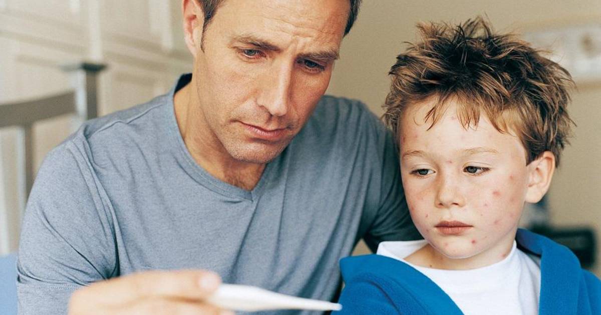 A l'aide! Mon enfant a la varicelle | Santé & bien-être | 7sur7.be