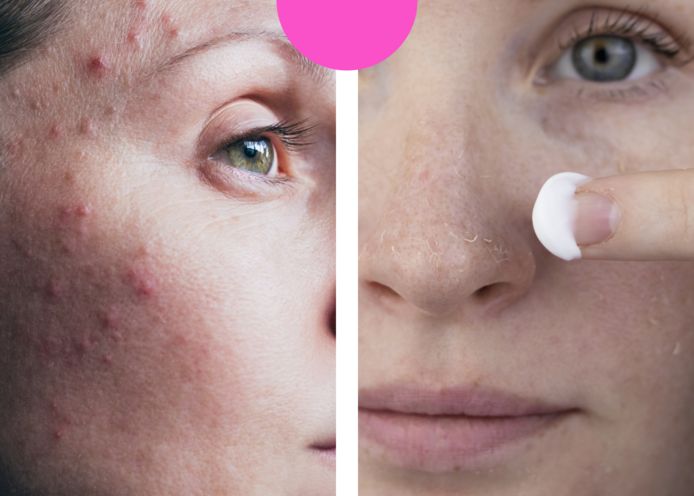 Je beschadigt je huid sneller dan je denkt: “Deze ingrediënten hebben ...