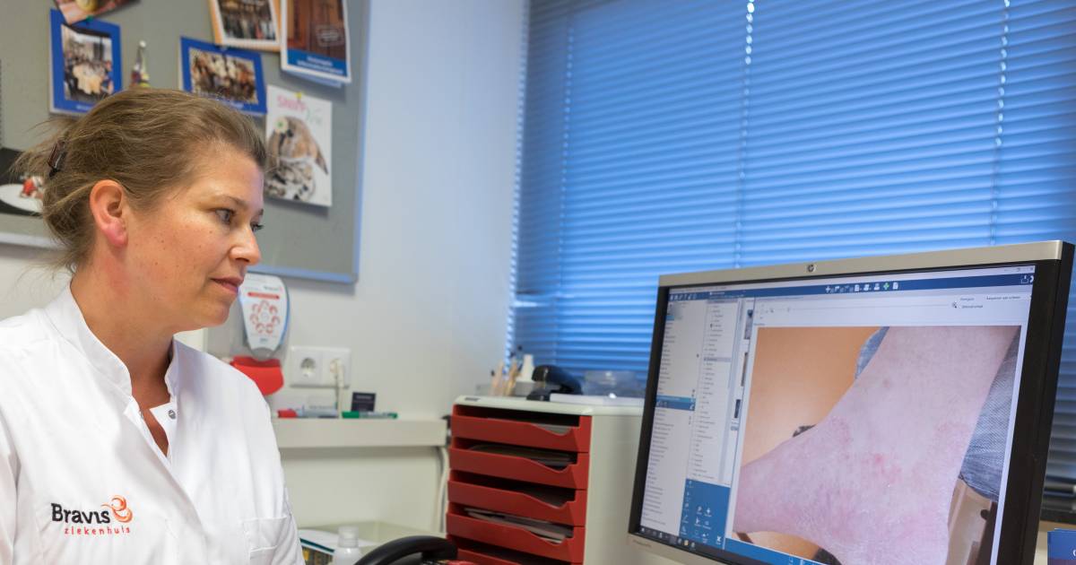 Dermatoloog vreest mensen met huidkanker te missen | Roosendaal ...