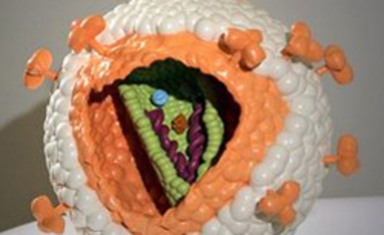 Effecten soa bij hiv-infectie ontdekt | Het Parool