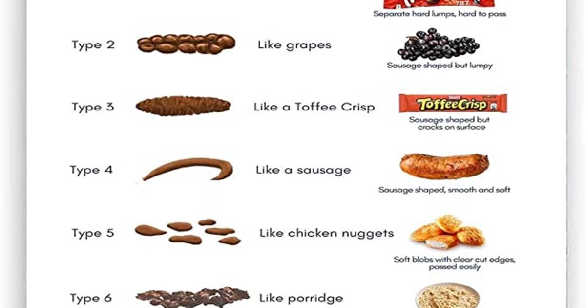 Aan je poep kun je zien hoe het met je darmen gaat: ‘Deze ontlasting ...