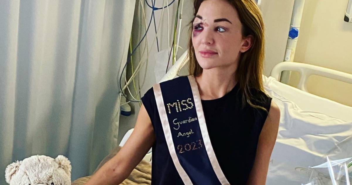 Miss België Chayenne toont voor het eerst zwaar toegetakeld gezicht na ...