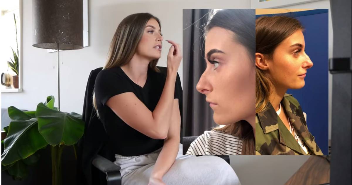 Demi uit ‘Temptation Island’ openhartig over neuscorrectie: “Heel duur ...