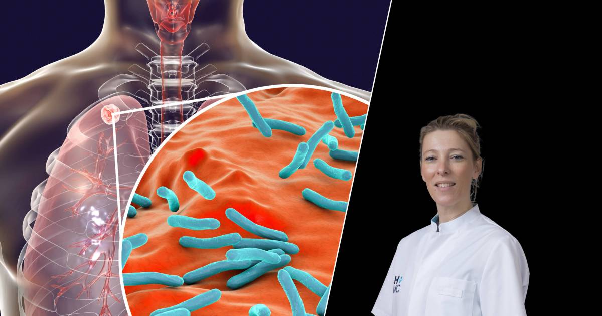 Meer mensen met tuberculose in Nederland: artsen leggen uit hoe deze ...