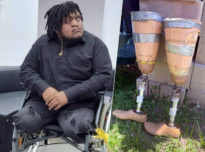 Giorgio liet zijn benen amputeren om weer te kunnen lopen, maar kreeg ...