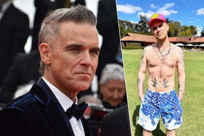 Robbie Williams overweegt plastische chirurgie na gewichtsverlies ...