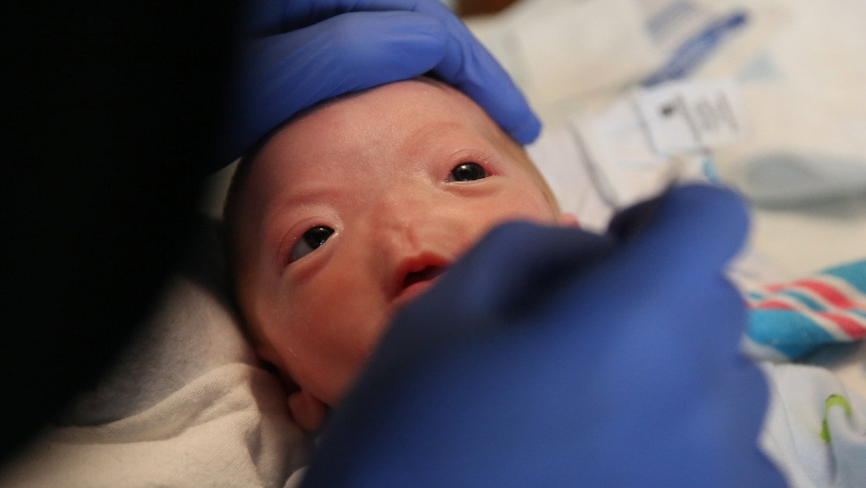 Facebook verwijdert foto van kereltje zonder neus, mama razend