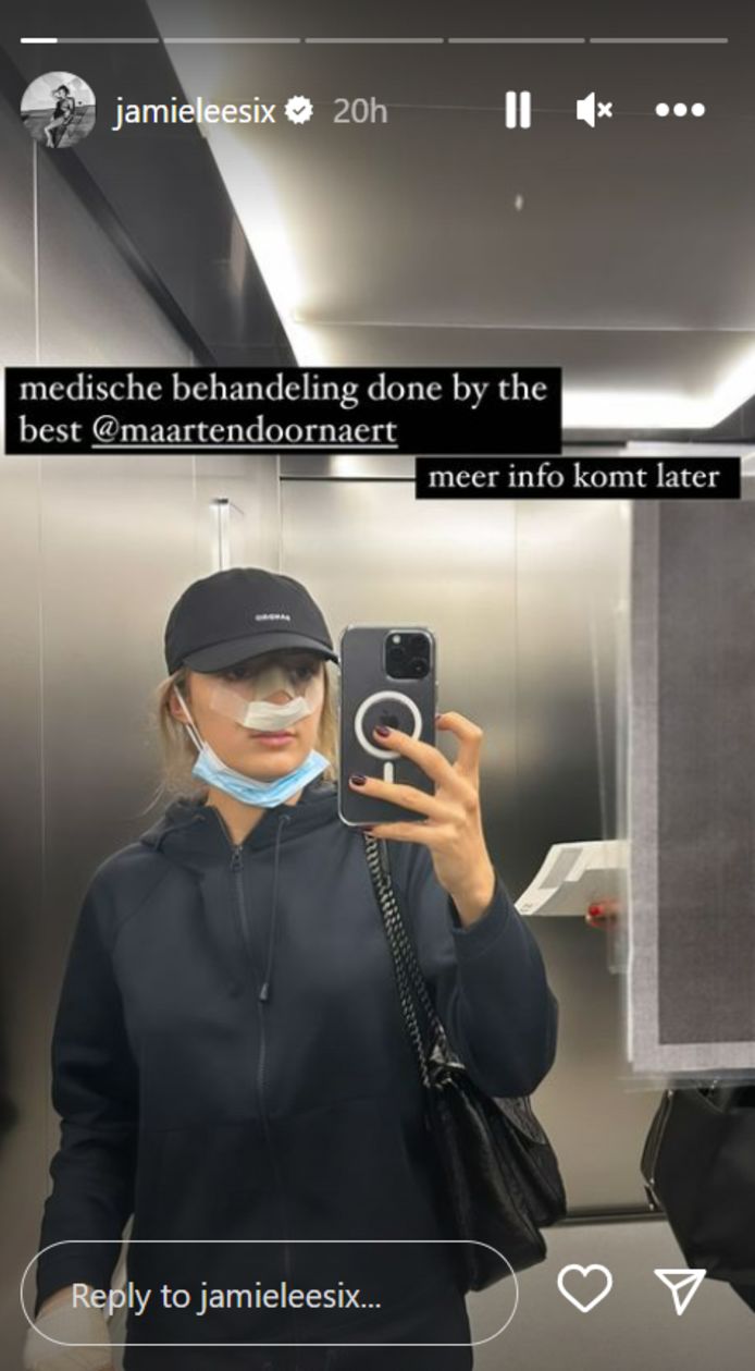 Jamie-Lee Six moest onder het mes: “Kon niet goed ademhalen door mijn ... Jamie-Lee Six moest onder het mes: “Kon niet goed ademhalen door mijn ...