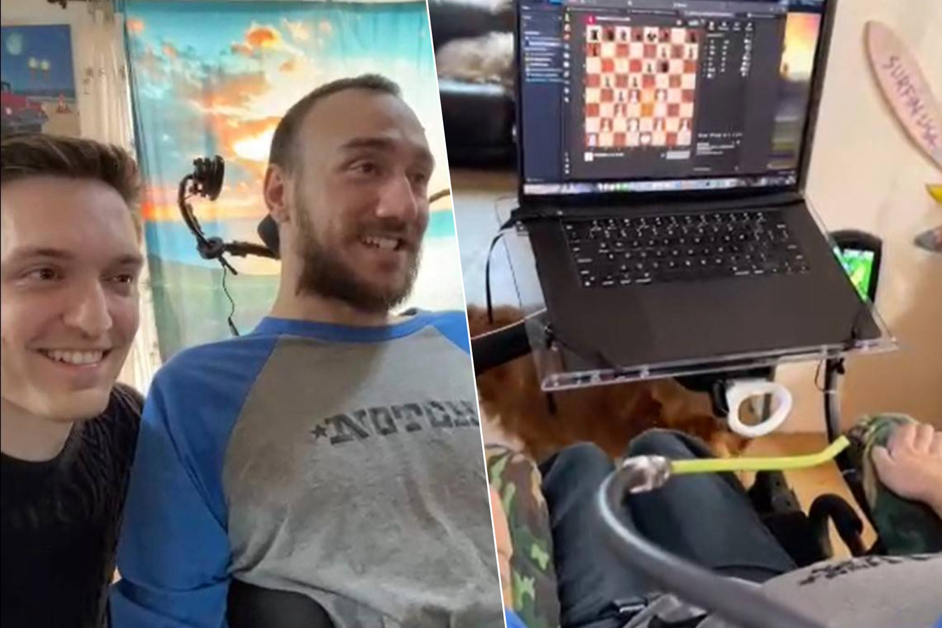 KIJK. Verlamde man die als eerste hersenchip van Elon Musk kreeg, kan ...