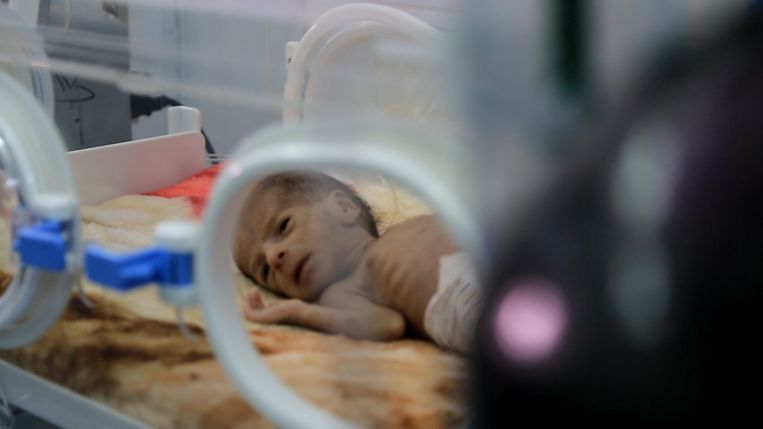 ‘Ik ben bang dat onze nieuwe baby ook misvormd is’: de onzichtbare ...