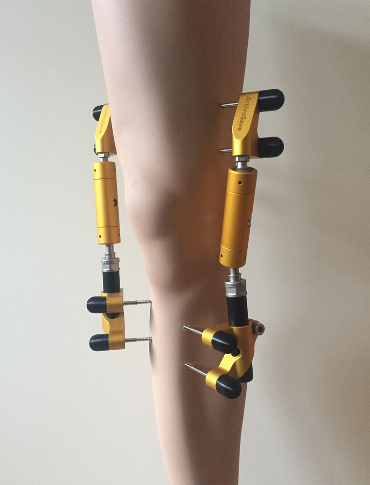 Een nieuwe knie zonder operatie: Utrechtse vondst gaat langzaam de ...