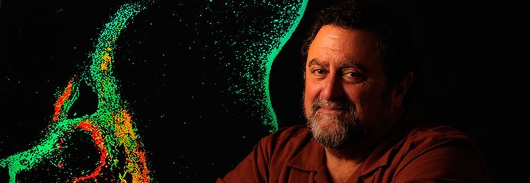 Neurowetenschapper James Fallon ondekte dat hij het brein heeft van een ...