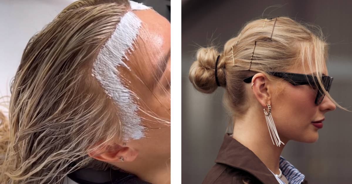 The Trendy 'Scandinavian Hairline': Why It's So Popular and How to Try ...