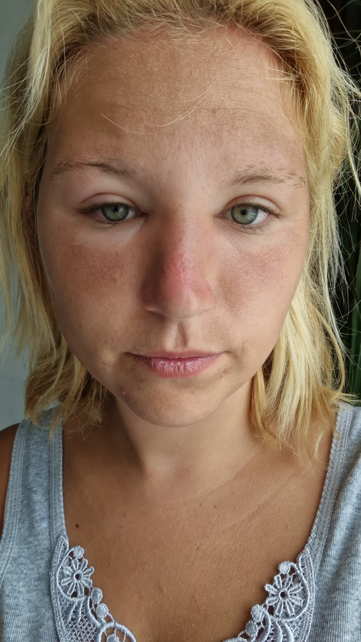 Gezicht Mariella Zwelt Helemaal Op Nadat Ze Haar Laat Vlechten Op