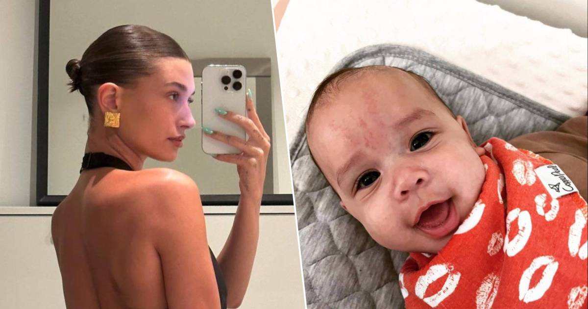 CELEB 24/7. Hailey Bieber geeft haar volgers een blik in haar leven en van wie is deze schattige ...