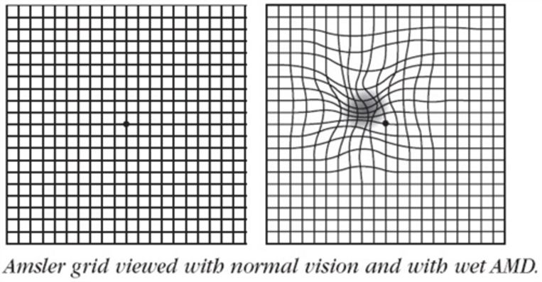 Oogproblemen: doe de test met de Amslerkaart | Margriet