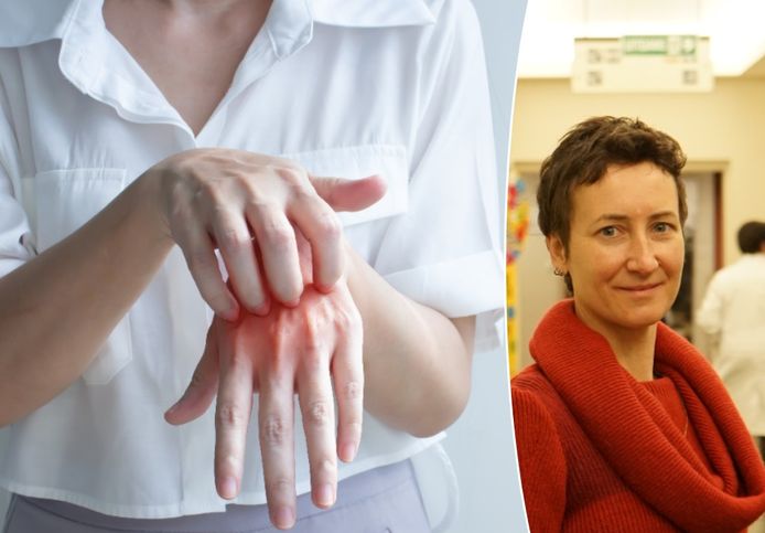 “Tot enkele weken na de behandeling kun je last blijven hebben”: expert ...