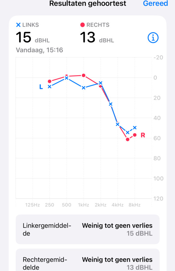Airpods als gehoorapparaat en gehoortest: 'De resultaten komen overeen ...