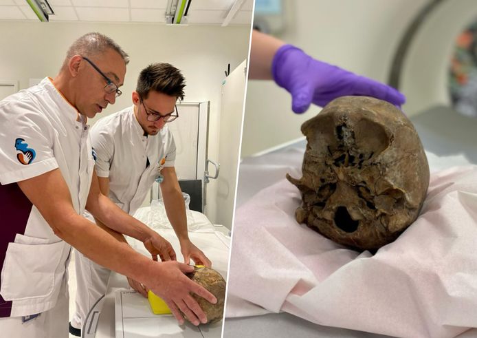 Zestig gebroken botten uit de middeleeuwen onder röntgenapparaat in ...