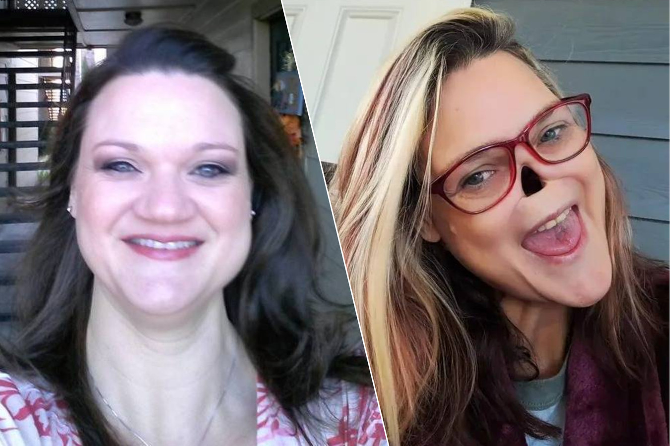 Tina gaat na agressieve kanker zonder neus door het leven: “Ik heb ...