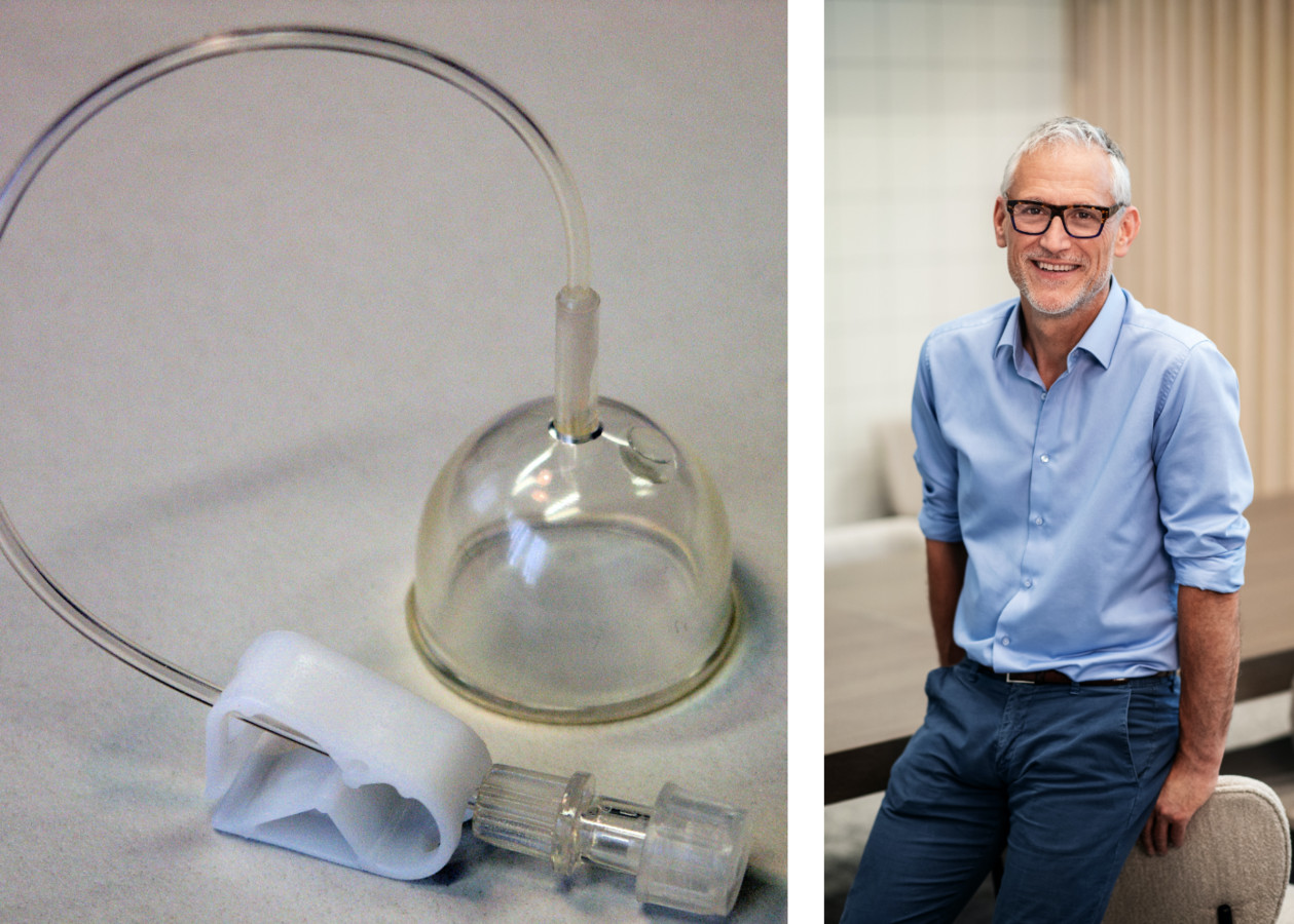 Makkelijk zelf insemineren: de donorcup is weer op de markt | Foto ...