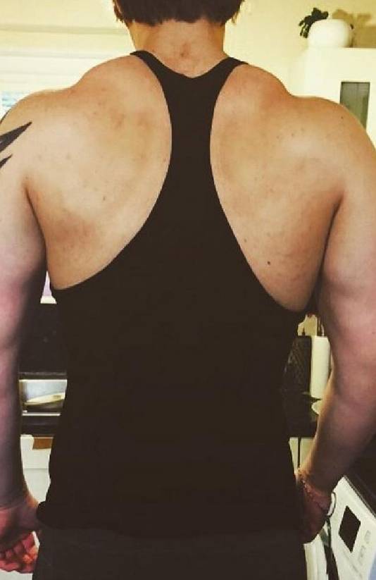 Bodybuilder (19) sterft nadat zijn hart was opgezwollen tot tweemaal de ...