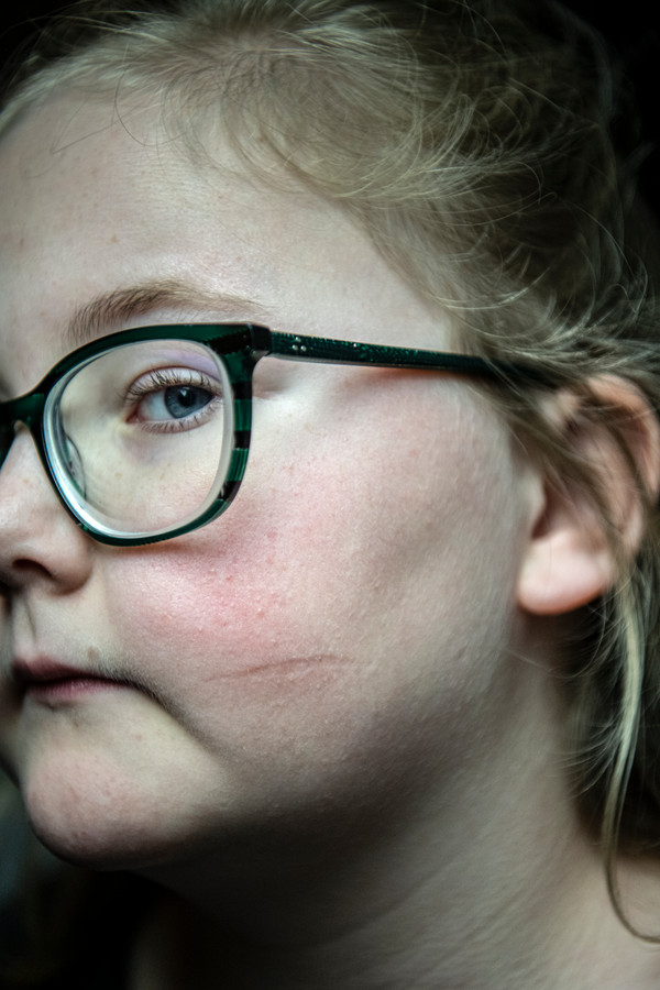 Onderzoek naar baby's die snijwond opliepen bij keizersnede | Foto | AD.nl