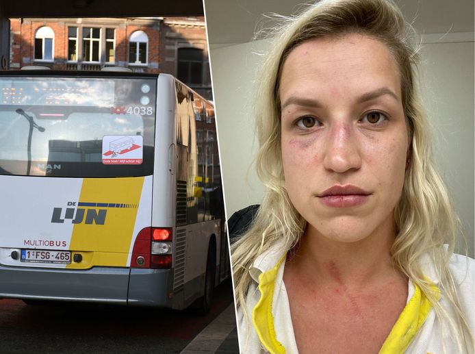 "Hij was geïrriteerd omdat ik 4 minuten te laat was": 17-jarige slaat buschauffeur Jilke neus ...