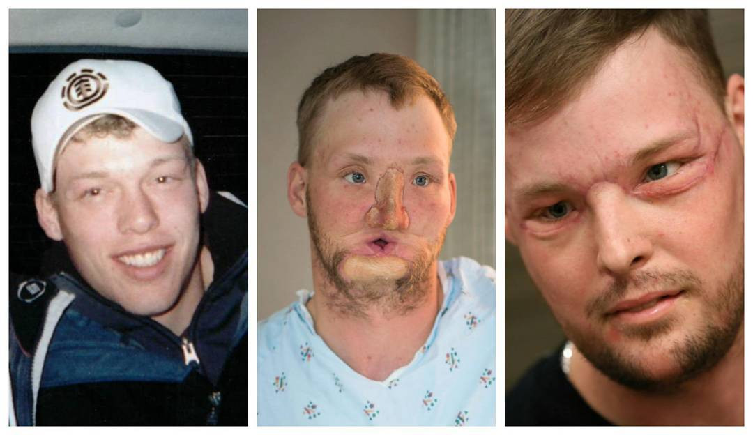 Peuter Leonard kan het gezicht van zijn overleden vader toch zien ...