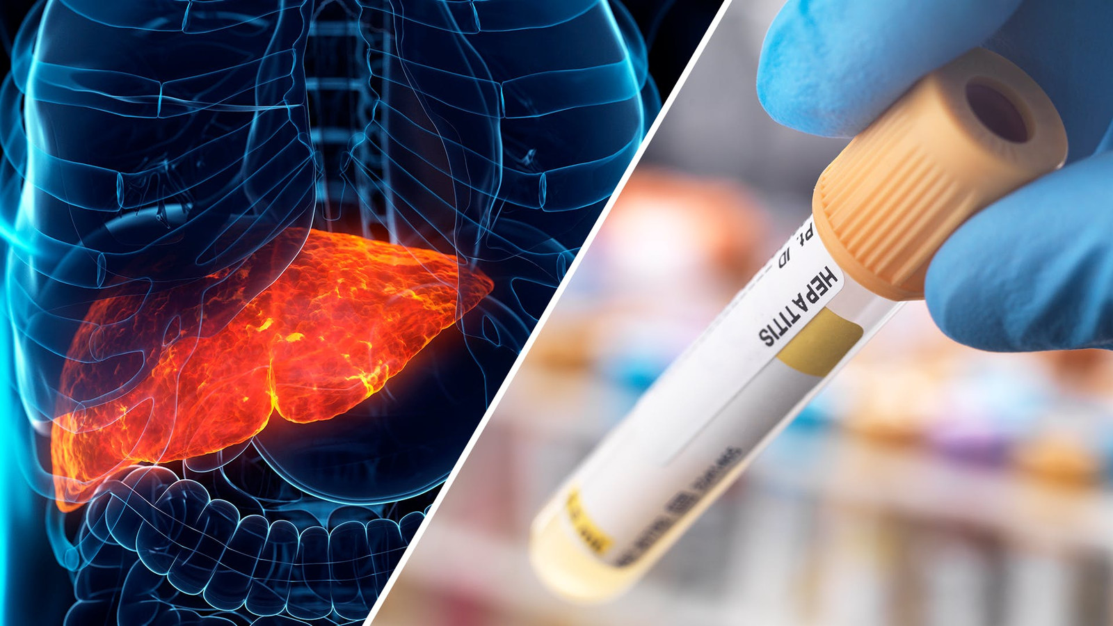 Britse gezondheidsdienst: ‘Meer bewijs dat adenovirus trigger lijkt ...