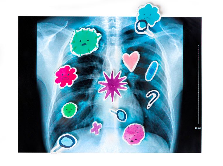 Nederlands onderzoek: kinderen hoeven na genezing van kanker niet ...