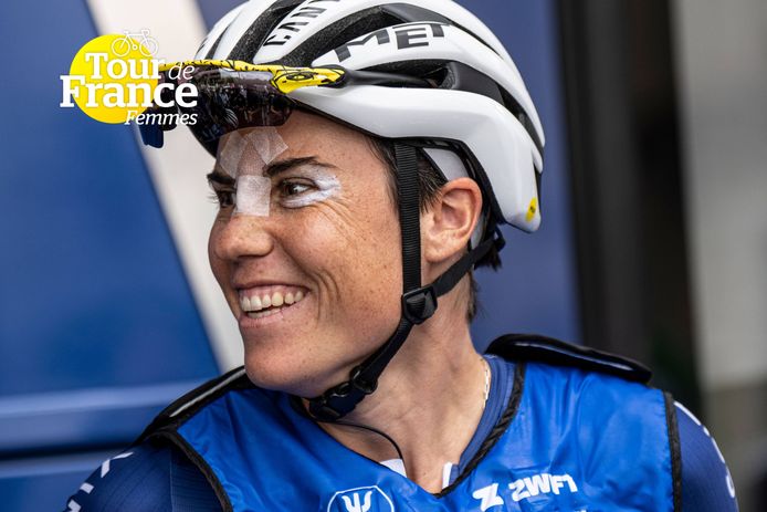 “Ik kus beide pollekes dat plastische chirurg het zo goed kon fiksen ...