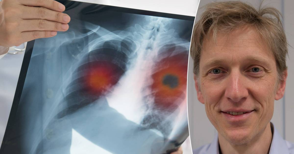 Steeds meer mensen krijgen longkanker, de dodelijkste kanker van ons ...