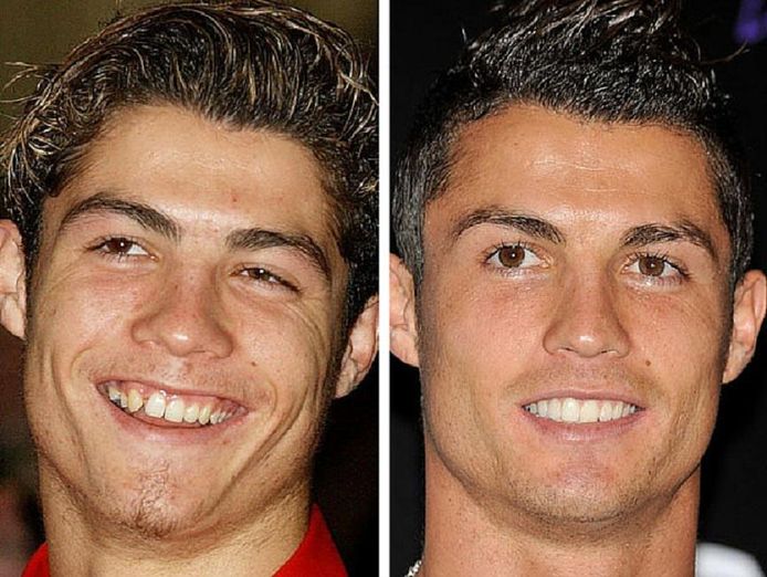 Cristiano Ronaldo, cet accro au Botox | Home | 7sur7.be