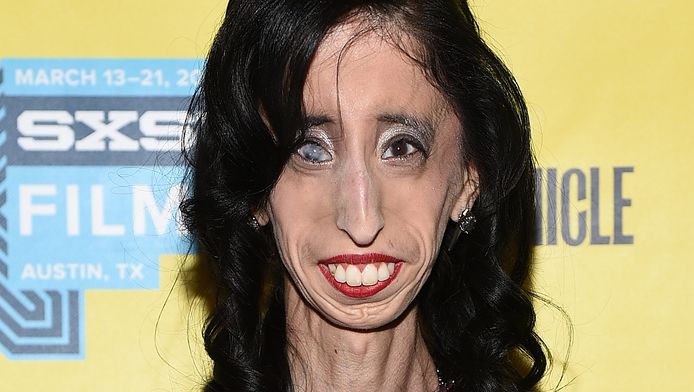 'Lelijkste vrouw ter wereld' vecht terug met aangrijpende documentaire ...