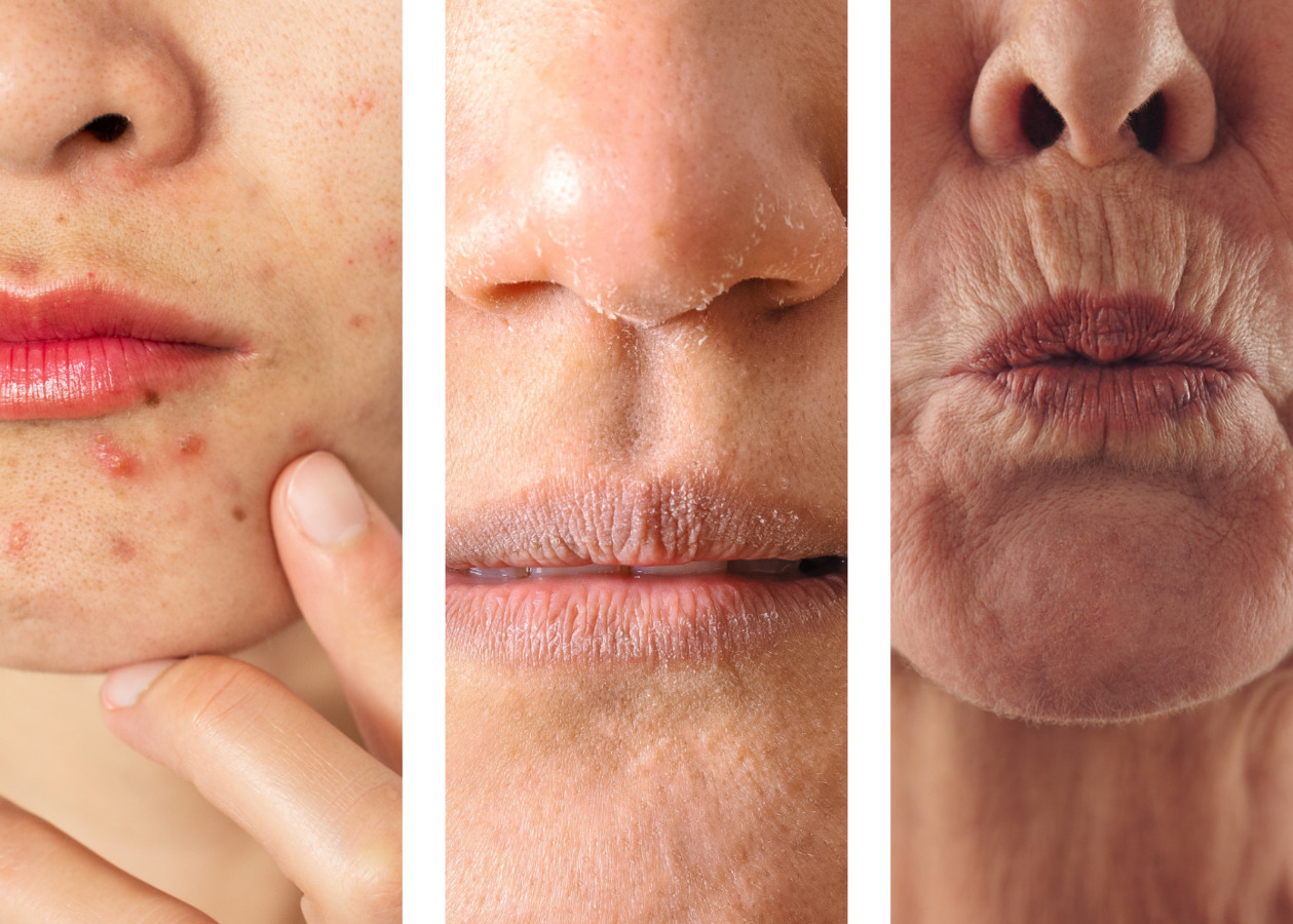 “Zo krijg je ook een rokersgezicht”: 3 experten over de pittige impact ...